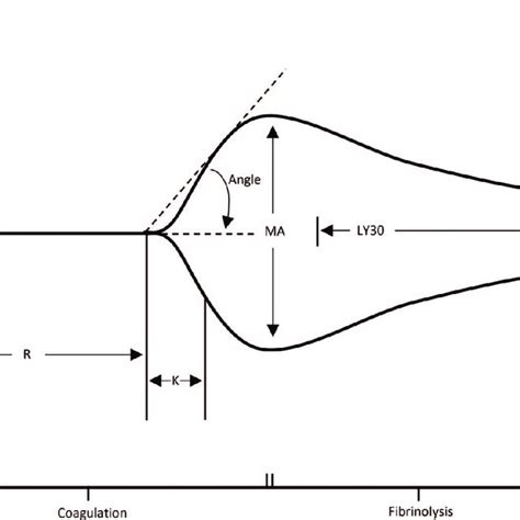 Thromboelastography Teg R Reaction Time K Kinetics Ma Maximum