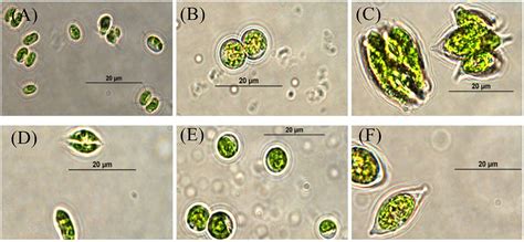 How To Identify Algae Under Microscope