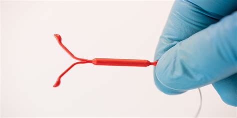 How To Check Your Iud Strings