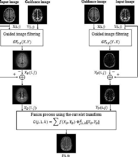 figure 1 from multimodal medical image fusion using guided filter and