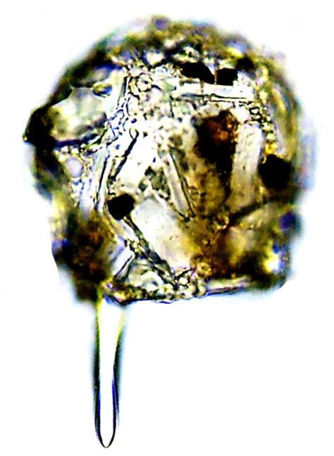 Difflugia Symoensi Tecamebas