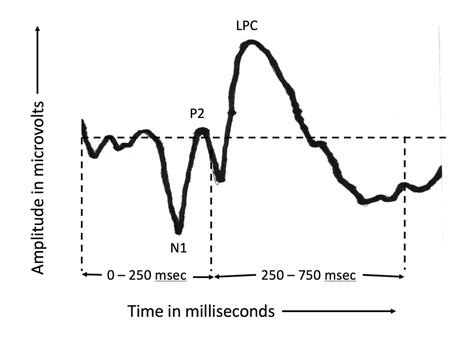 The Remarkable History Of Right Ear Advantage The Hearing Review