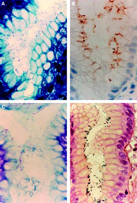 Giemsa Stain Helicobacter Pylori
