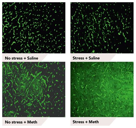 Bad Breaks How Stress And Meth Use Combine To Dramatically Weaken The