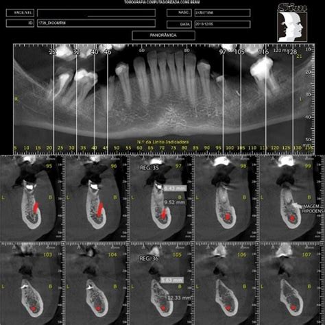 Initial Computed Tomography Download Scientific Diagram