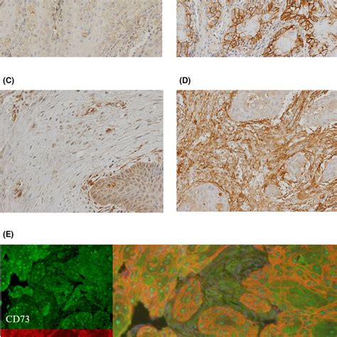 Expression Patterns And Localization Of Extracellular Matrix Download Scientific Diagram