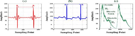 Figure 2 From Contactless And Short‐range Vital Signs Detection With Doppler Radar Millimetre
