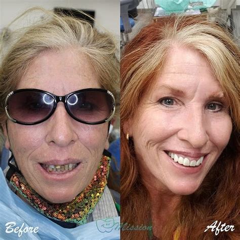 Home Dentist In Miami Fl The Smile Mission