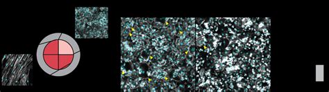 Osteoclast Formation In Human Osteoblastosteoclast Precursor