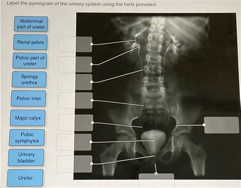 Solved Label The Pyelogram Of The Urinary System Using The