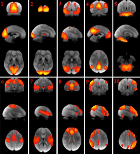 Ten Sample Reference Rsns Rsns 1 2 And 3 Correspond To A Visual