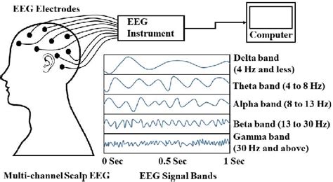Figure From A Smart Mandibular Device For Intra Oral Electroencephalogram Monitoring