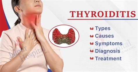 Thyroiditis Types Causes Symptoms Diagnosis And Treatment