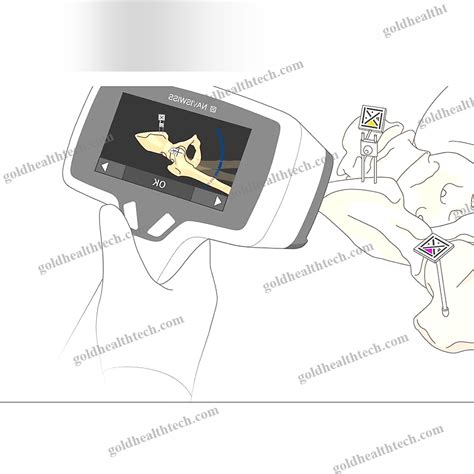 Orthopedic Surgery Surgical Navigation System Gold Health Tech