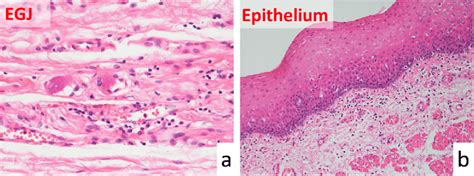 Esophagus Microscopic View A Slight Myenteric Plexus Inflammation Download Scientific