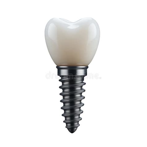 Dental Implant Tooth Replacement Dental Care Oral Health Prosthetic