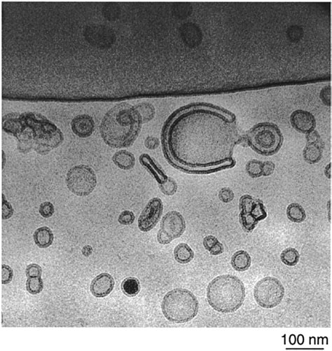 Vesicles Micrograph