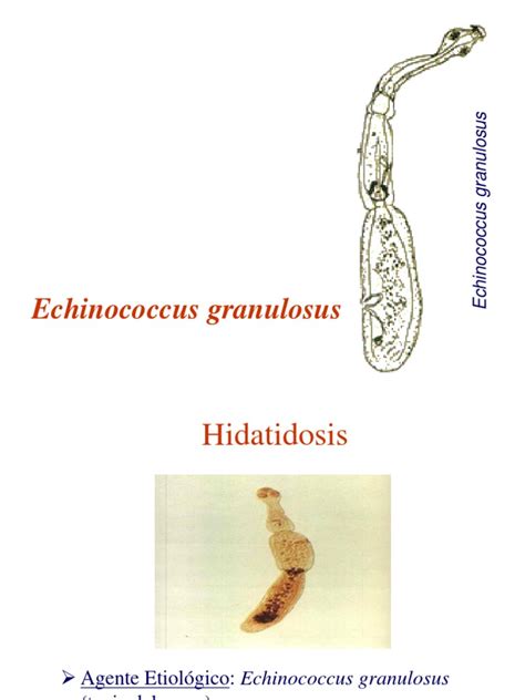 4 Echinococcus Granulosus Pdf