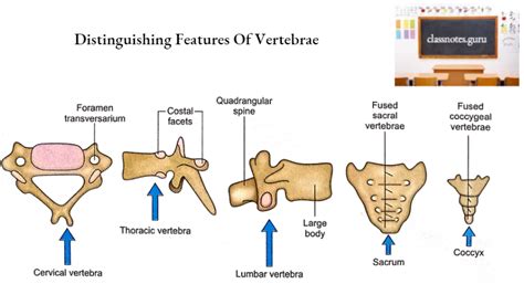Vertebrae Osteology Notes Class Notes