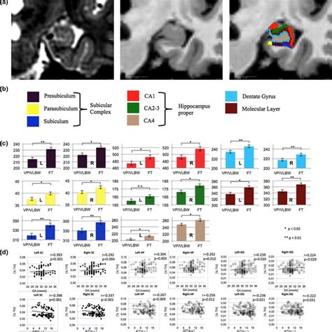 A Hippocampus Subfield Segmentation Exemplary Hippocampus Subfield