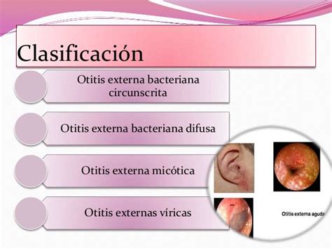 Tipos De Otitis Externa Otitis En Niños Qué Es Tipos Y Tratamiento