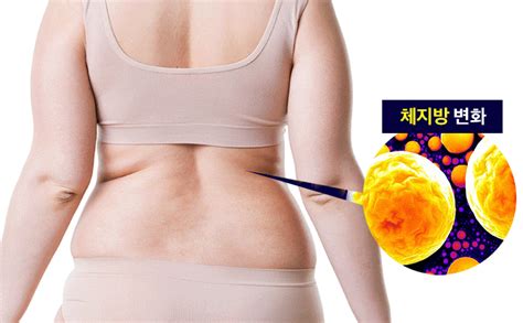 정왕동 헬스장 장내 박테리아가 복부 지방을 제거한다