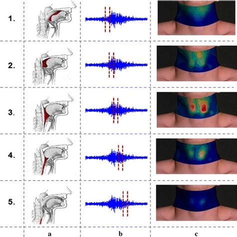 Pdf Evaluation Of Normal Swallowing Functions By Using Dynamic High