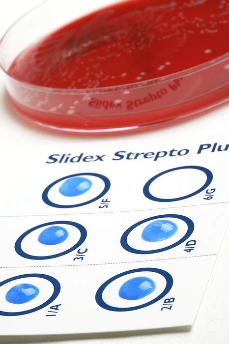 Streptococcus Grouping Test Greeting Card By Science Photo Library