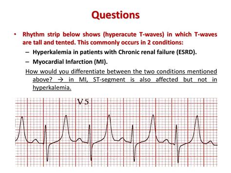 Presented By Dr Taysir Prepared By Ali Jassim Alhashli Ppt Download