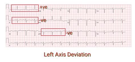 Pin On Ιατρική