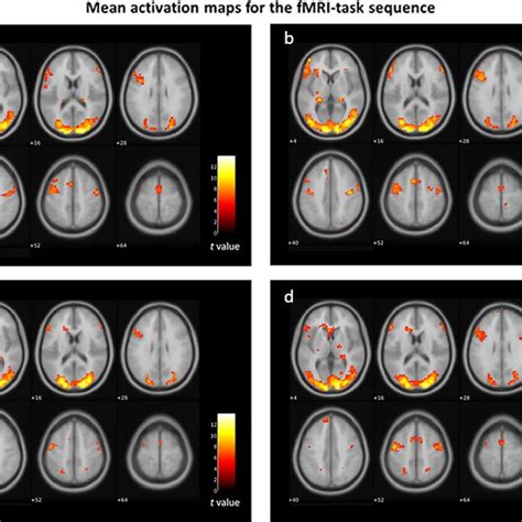 Plots For The Quality Metrics For Resting State Functional Mri Download Scientific Diagram