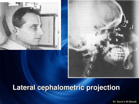Extraoral Radiographic Techniques Ppt Download