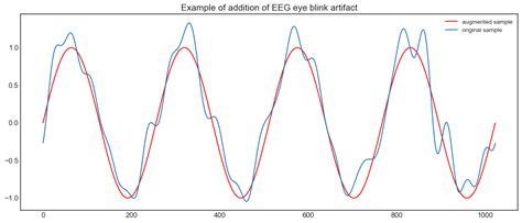 Data Augmentations Guide — Selfeeg 0 2 1 Documentation