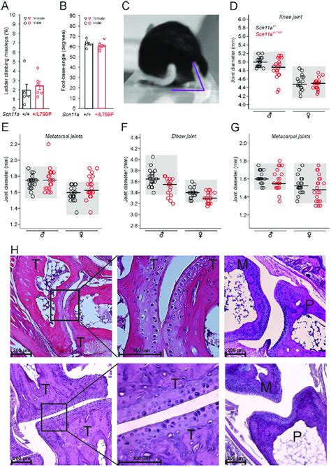 Quantitative Gait Analysis And Joint Diameters No Differences In The Download Scientific