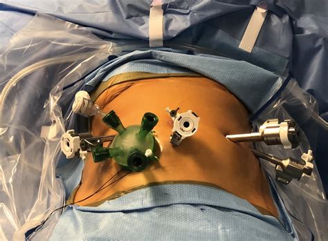 Robotic Gastrectomy Clinical Tree