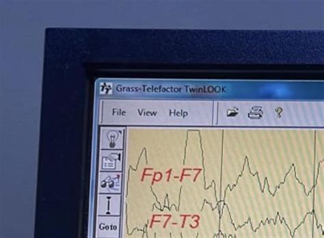 Eeg Software R Neurology