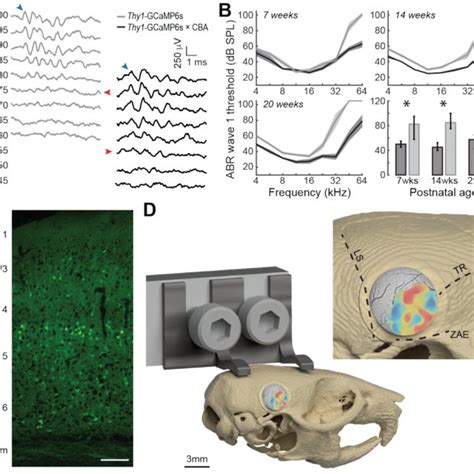 Mapping The Core And Higher Order Fields Of The Mouse Auditory Cortex