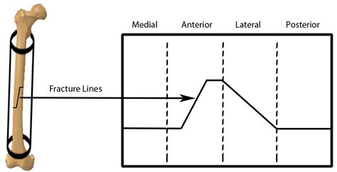Exploring Fracture Patterns Assessing Representation Methods For Bone