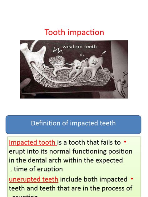 Dr Fidaa Impaction 1 Pdf Human Tooth Dental Anatomy