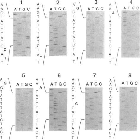 Mutations In The Gyra Gene From Clinical Isolates Identified On Dna Download Scientific Diagram