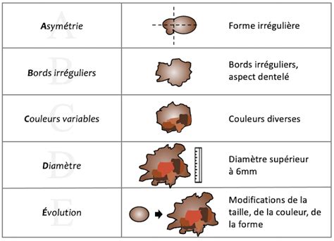 Gare Au Cancer De La Peau Le Plus Agressif Le Mélanome Cutané L