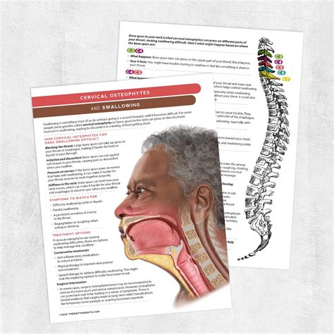 Cervical Osteophytes And Swallowing Adult And Pediatric Printable