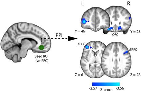 Figures And Data In Human Vmpfc Encodes Early Signatures Of Confidence