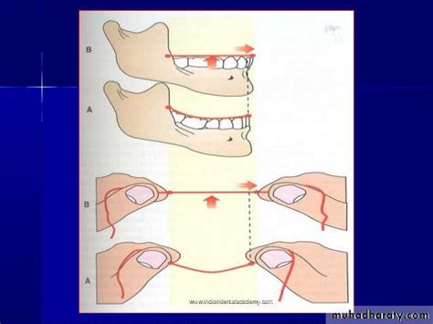 Cast Analysis Pptx غير معروف Muhadharaty
