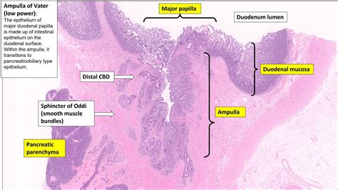 Ampulla Normal Histology Nus Pathweb Nus Pathweb
