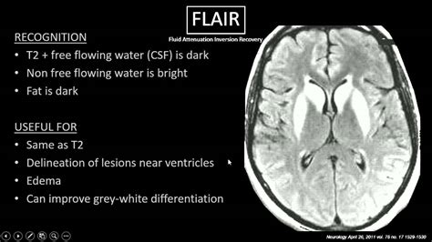 Mri Sequences Sequence Classification E Mri