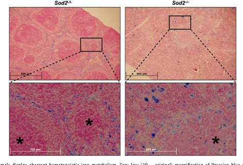 Erythroid Precursor Cells Semantic Scholar