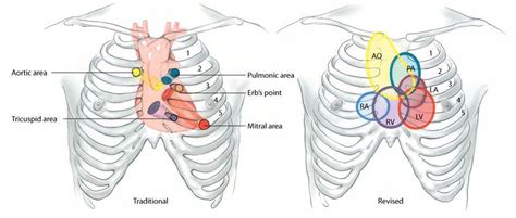5 Cardiac Sites For Auscultation Tlwk