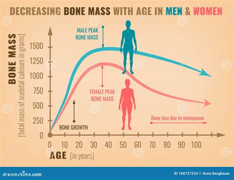 Decreasing Bone Mass Vector Illustration 109174772