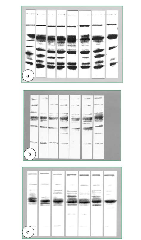 Antigenic Proteins Of Clinical Isolates Of Helicobacter Pylori Strains Download Scientific